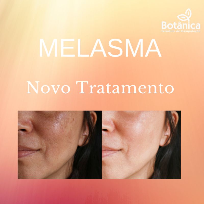 Cysteamine 5% (cisteamina) 30g creme para tratamento melasmas ...