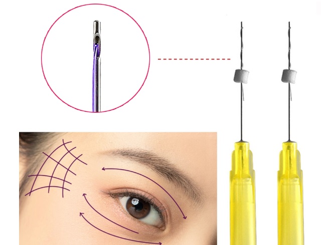 Fios de Pdo Canulado Eye Thread liso 30G x 25mm (Pacote 10 unidades ...