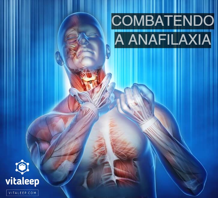 O QUE É ANAFILAXIA? - Vitaleep - Assessoria na Importação de Medicamentos