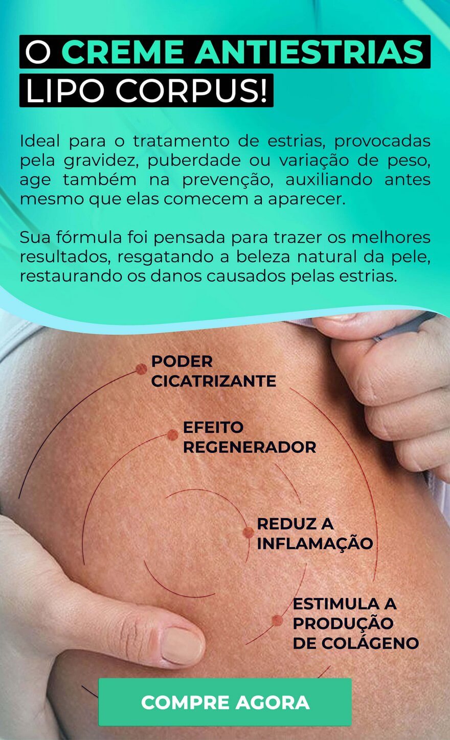 creme-de-estrias - Lipo Corpus | Gel Redutor de Medidas e Anti Celulite