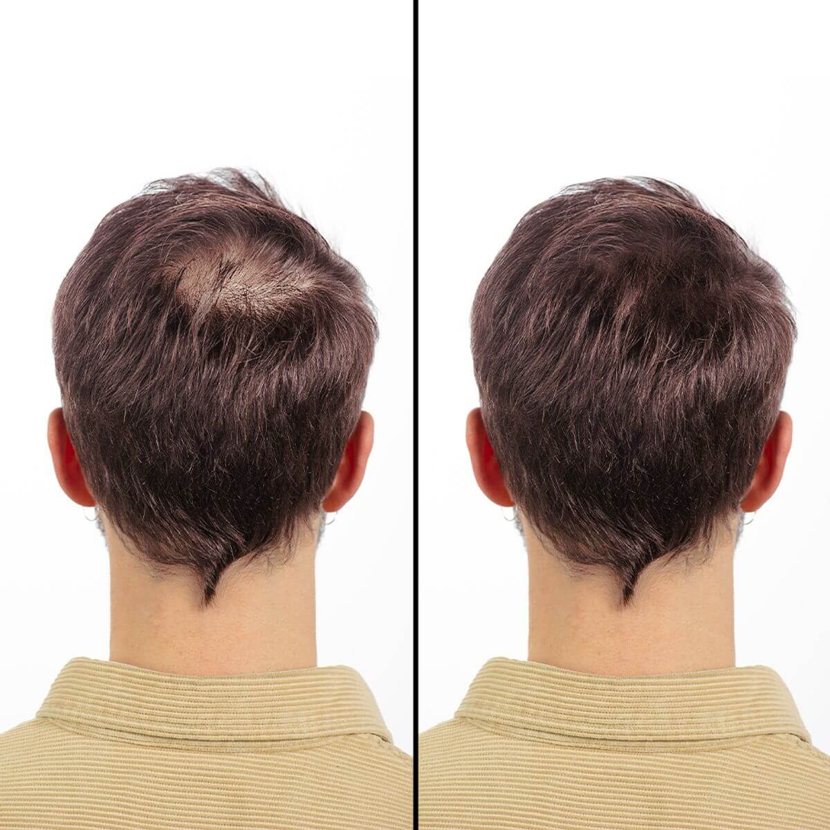 Fibra Capilar Para Cabelos Castanho Claro 25G - Vertix - Condessa Cosméticos e Perfumaria