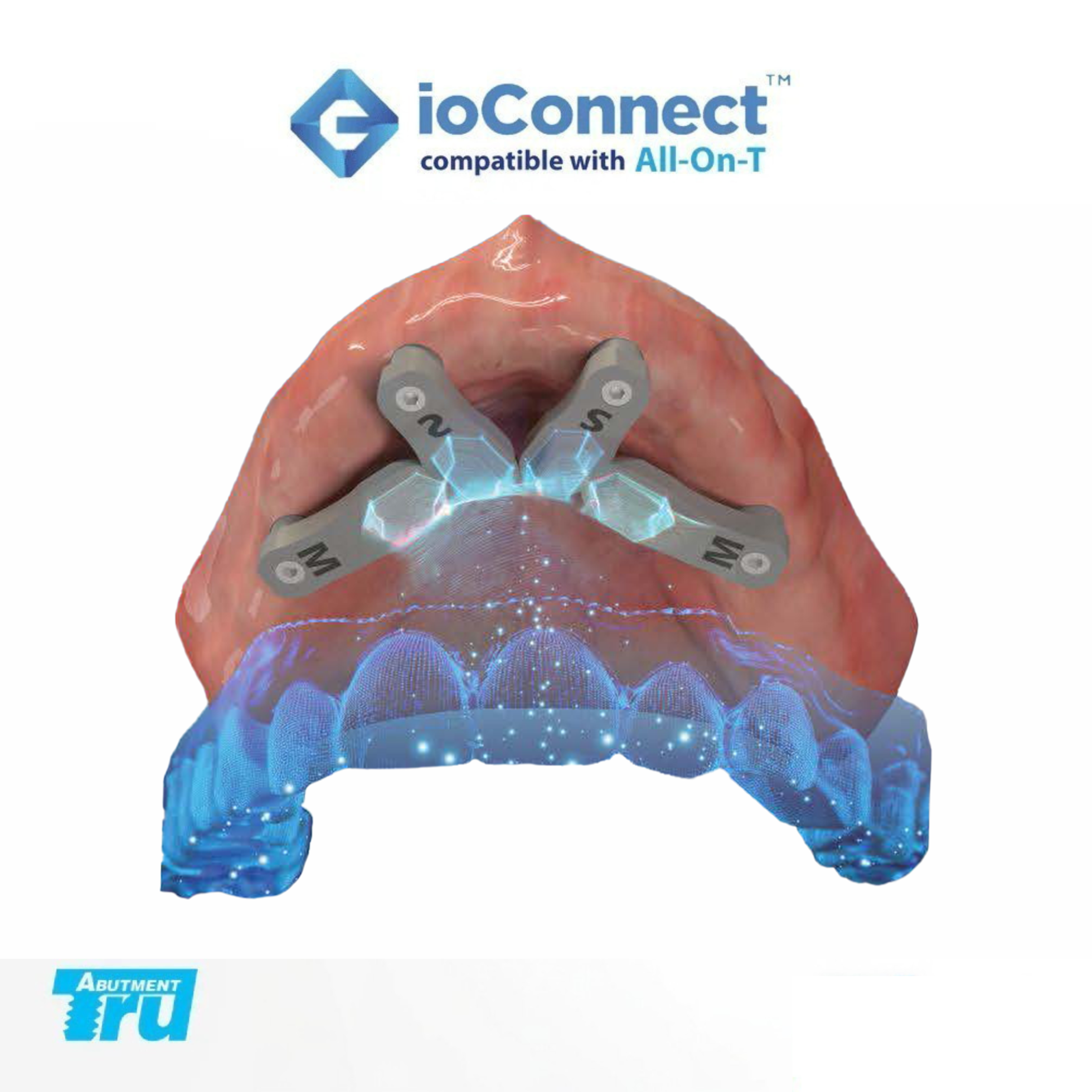 ioConnect TruAbutment - SMART DENT