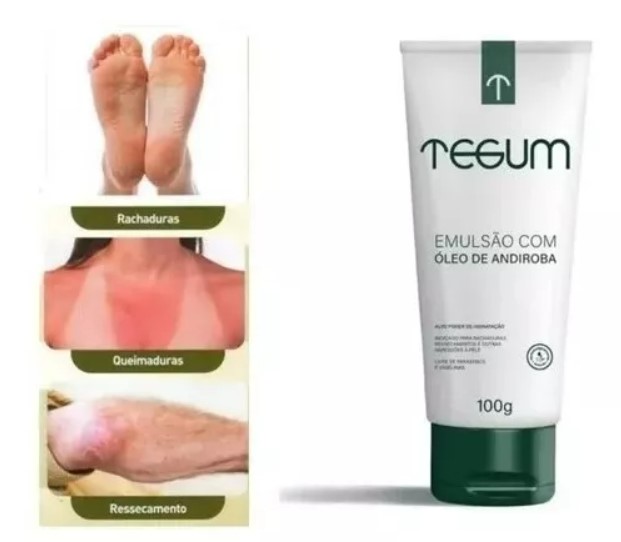 Creme Tegum Emulsão Com Óleo De Andiroba 100gr - Tegum - Cirúrgica ...