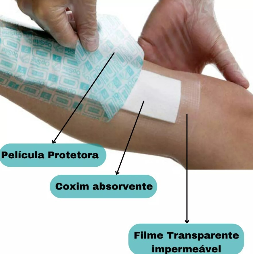 Curativo Opsite Post-Op Com Compressa Absorvente 30cm x 10cm Unidade ...