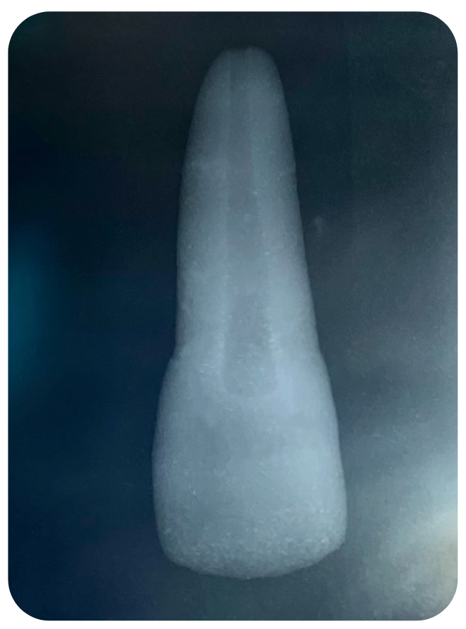 DENTES ENDO (DE 21 À 27 E 31 À 37) POLPADO RADIOPACOS - Orais Manequins ...