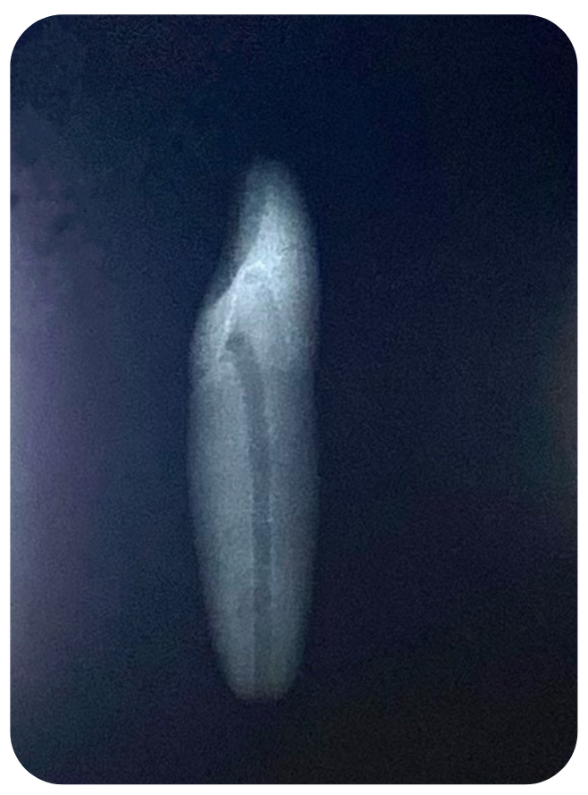 DENTES ENDO (DE 21 À 27 E 31 À 37) POLPADO RADIOPACOS - Orais Manequins ...