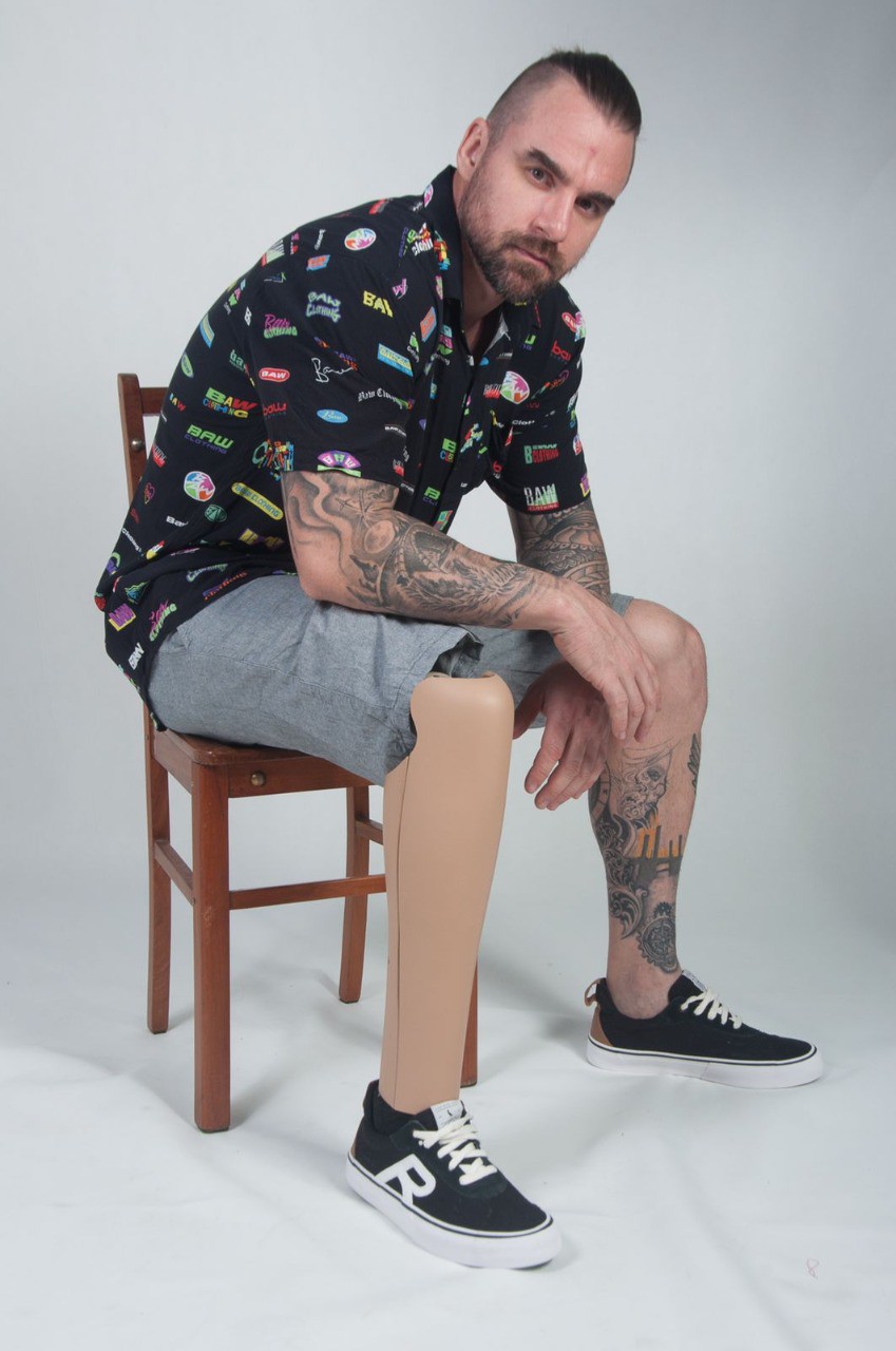 Capa para Prótese Transfemoral Confetti II Canvas - Loja do Amputado