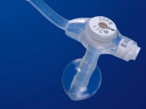 SONDA DE GASTROSTOMIA DE BAIXO PERFIL COM BALÃO - MICKEY - AVANOS ...