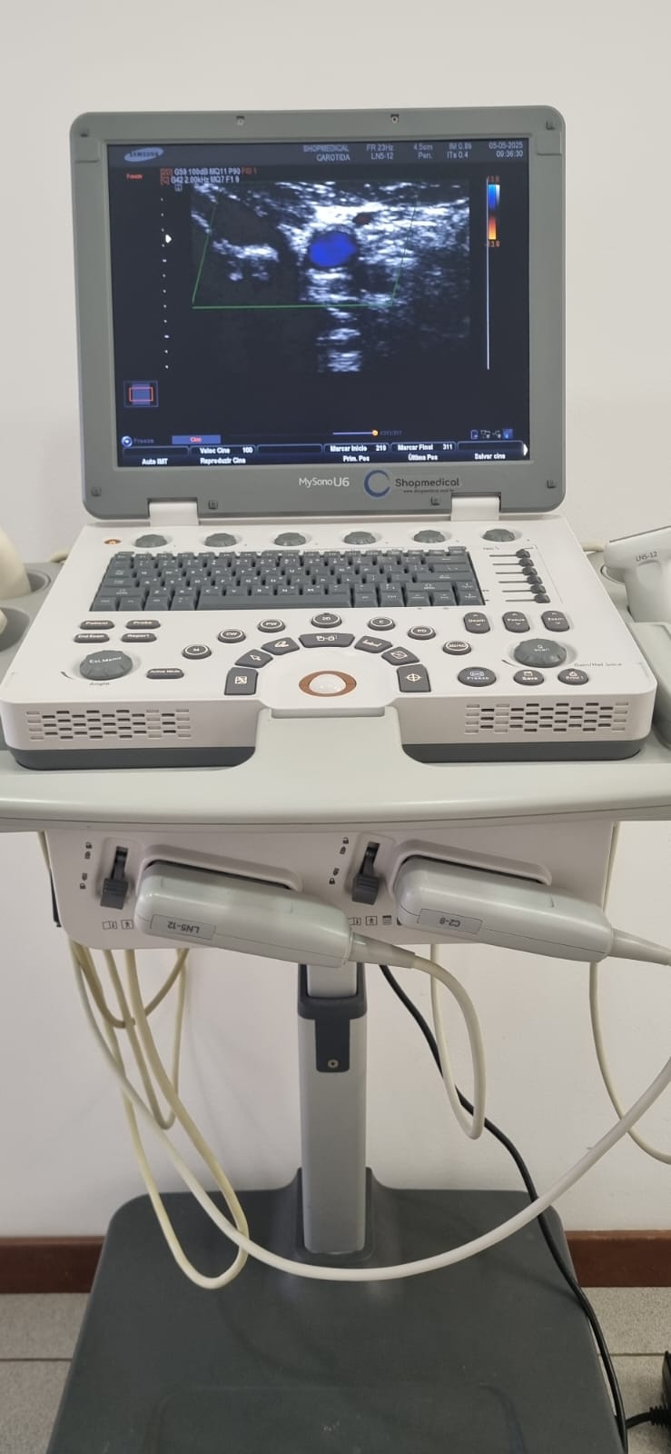 Ultrassom Portátil MySono U6 - Linear e Setorial - SAMSUNG - Shopmedical