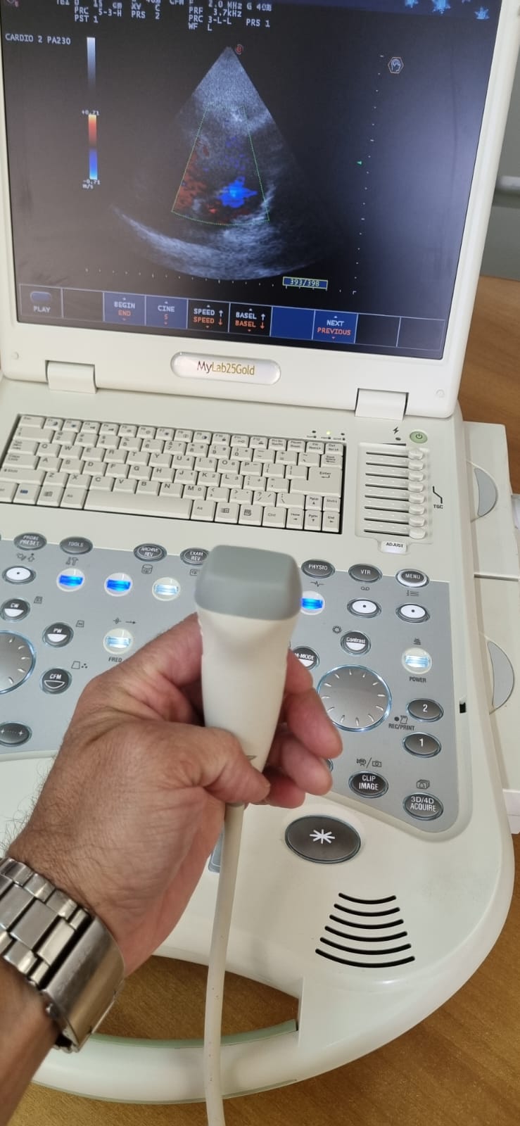 Ultrassom Portátil MyLab 25 Gold - Linear e Setorial Adulto - Esaote ...