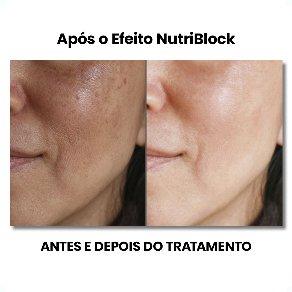Nutriblock Anti-Melasma - Protetor Solar Oral Natural e Inovador - Progressiva Orgânica ...