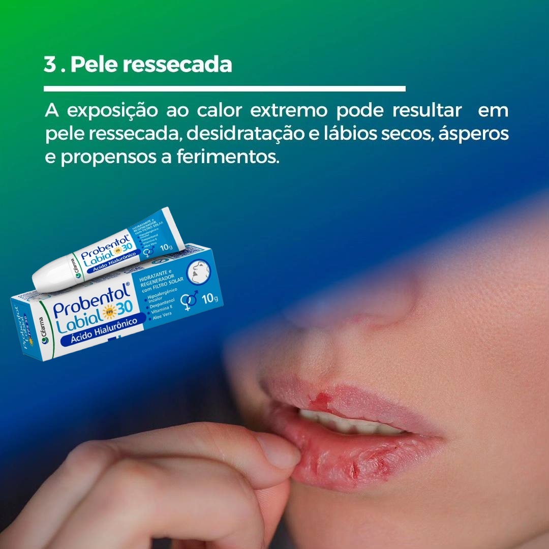 PROBENTOL LABIAL FPS 30 10GR CIFARMA - FarmaViver - Farmácia Online 24 ...