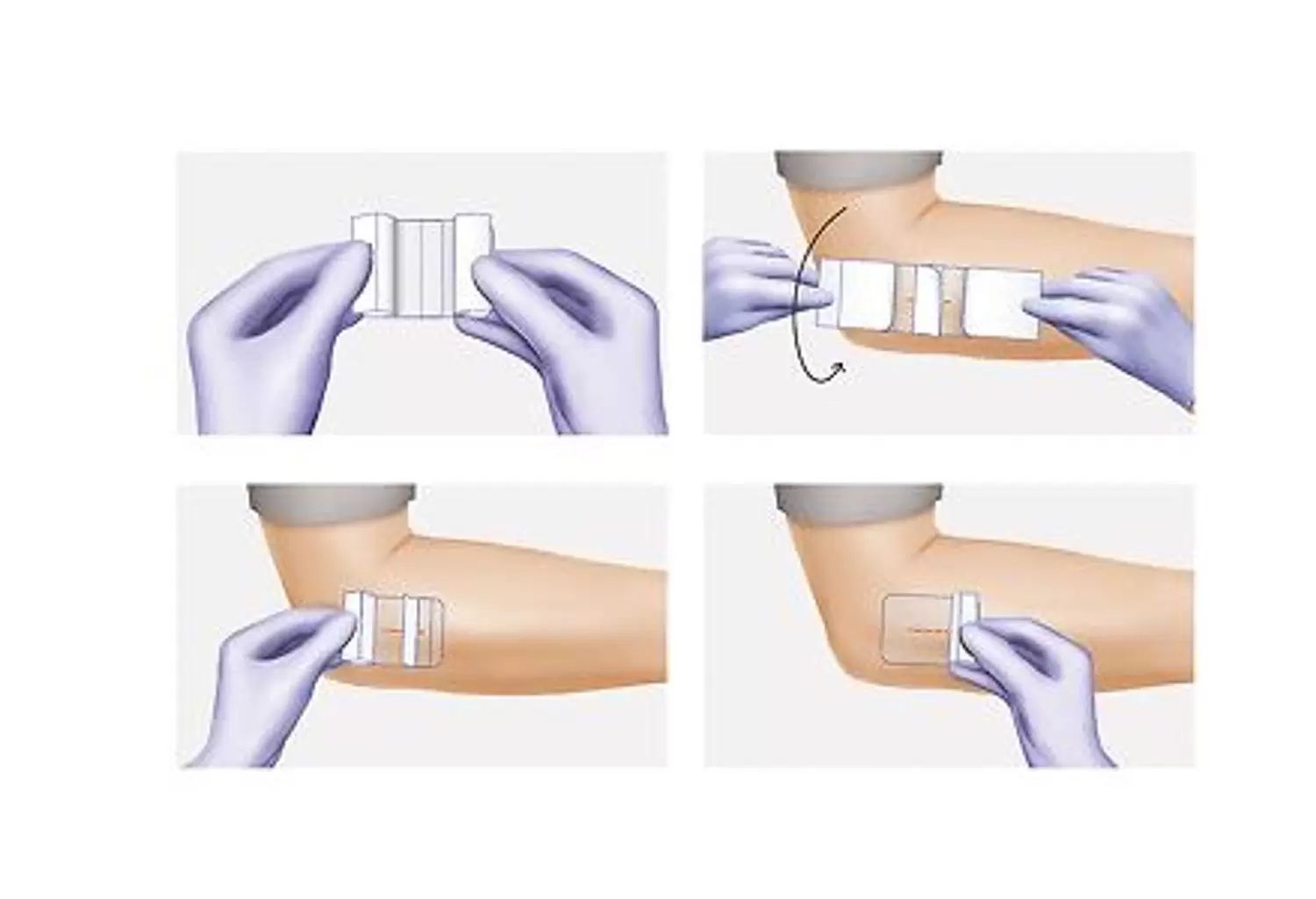 Curativo Hydrofilm Penso Auto-Adesivo 10X15 cm - Sunnypé - Sunnypé ...