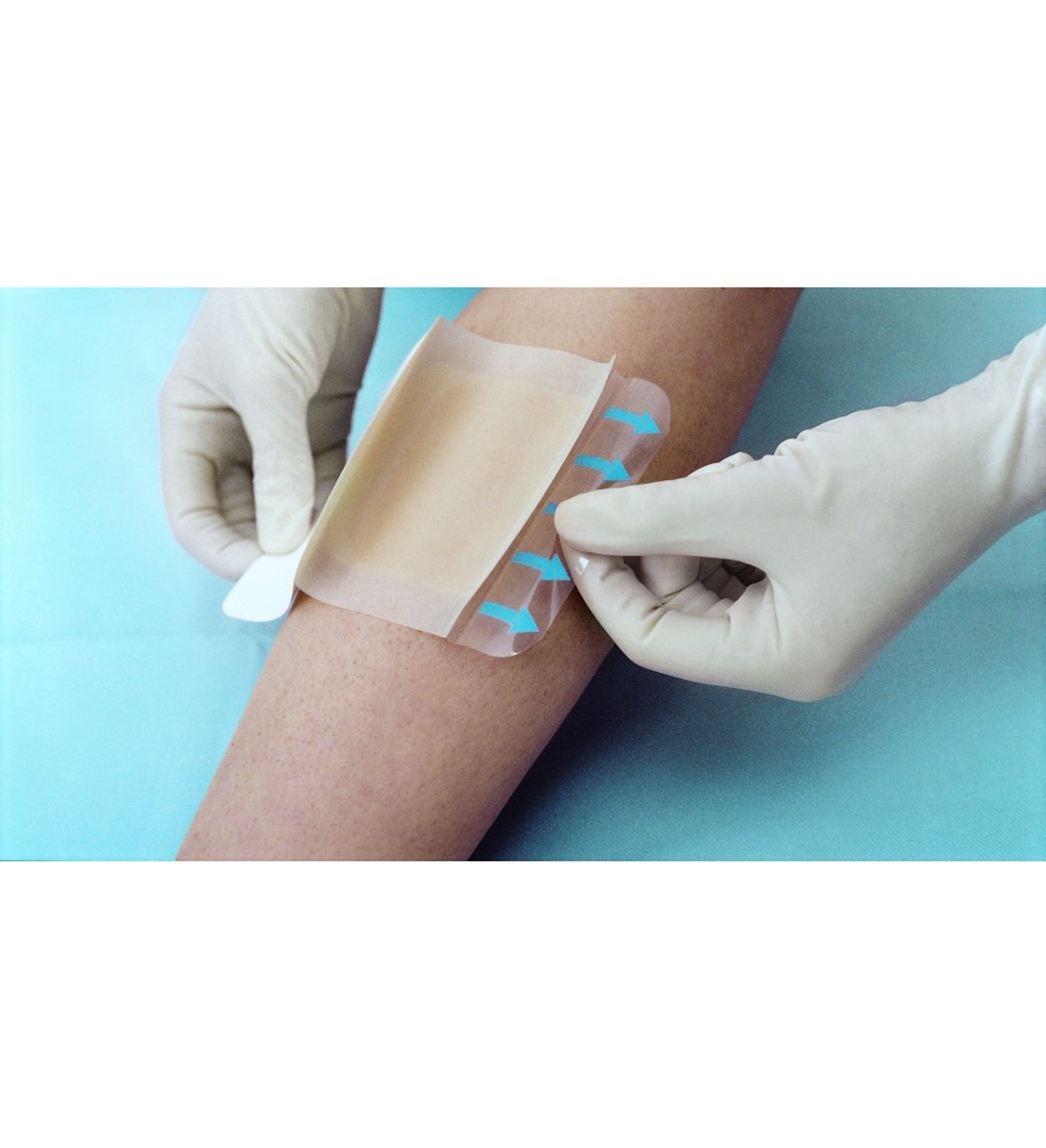 Curativo Placa de Hidrocolóide Hydrocoll 10x10cm - Hartmann - Cirúrgica ...