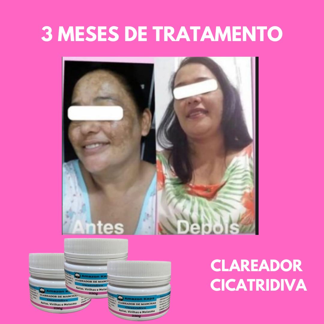 CLAREADOR DE MANCHAS AMAZOLE - Amazon kaps