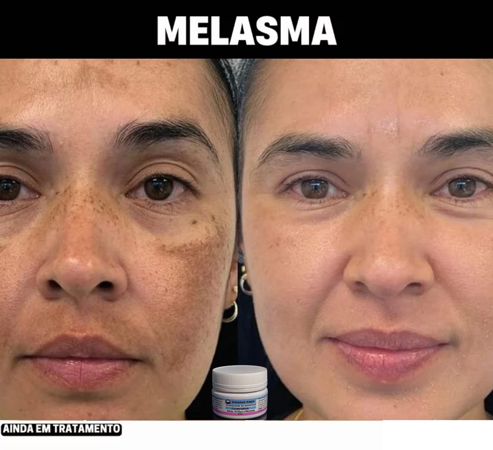 CLAREADOR DE MANCHAS AMAZOLE - Amazon kaps