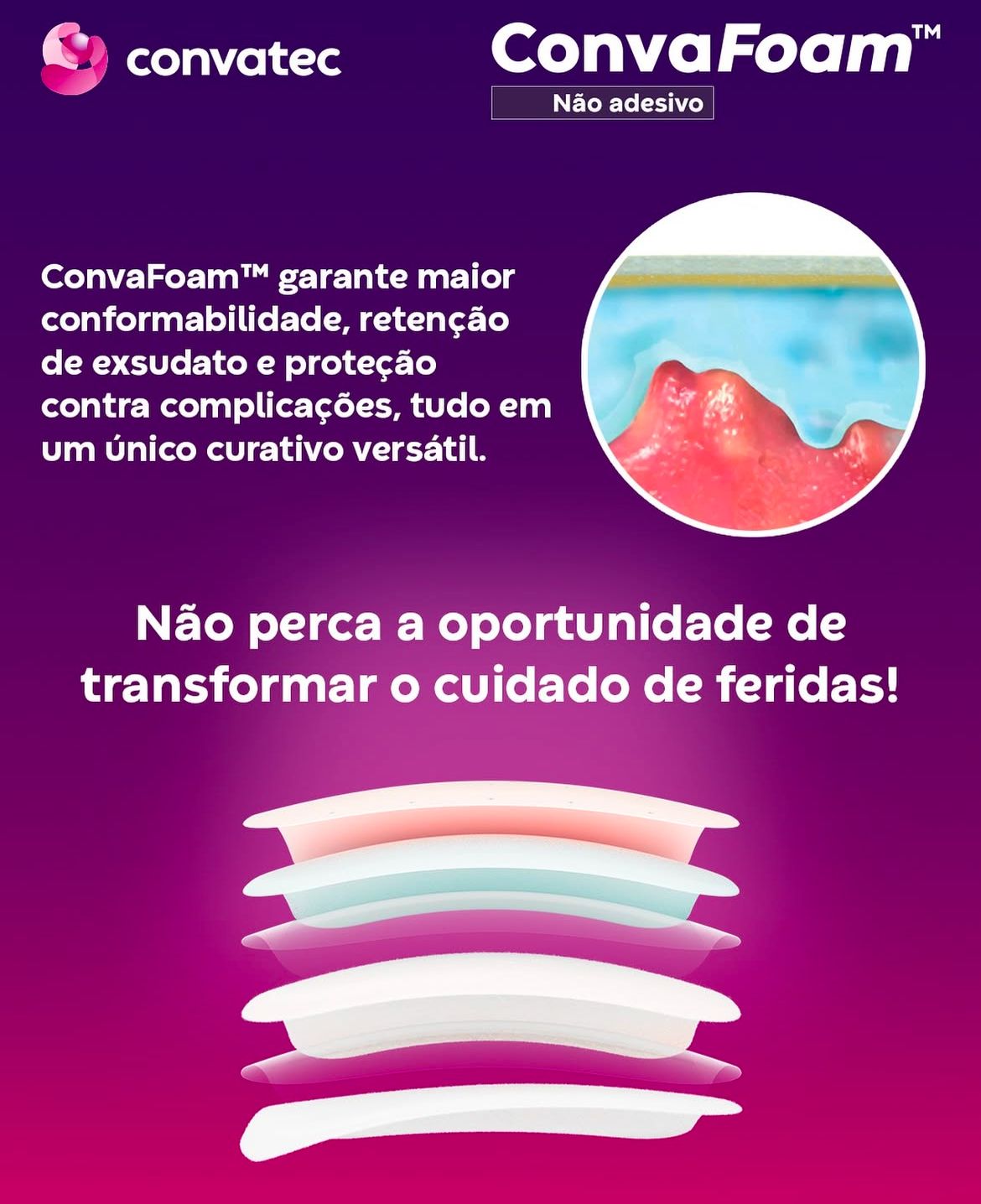 Curativo Convafoam Espuma 10cm X 10cm Não Adesivo Unidade Convatec ...