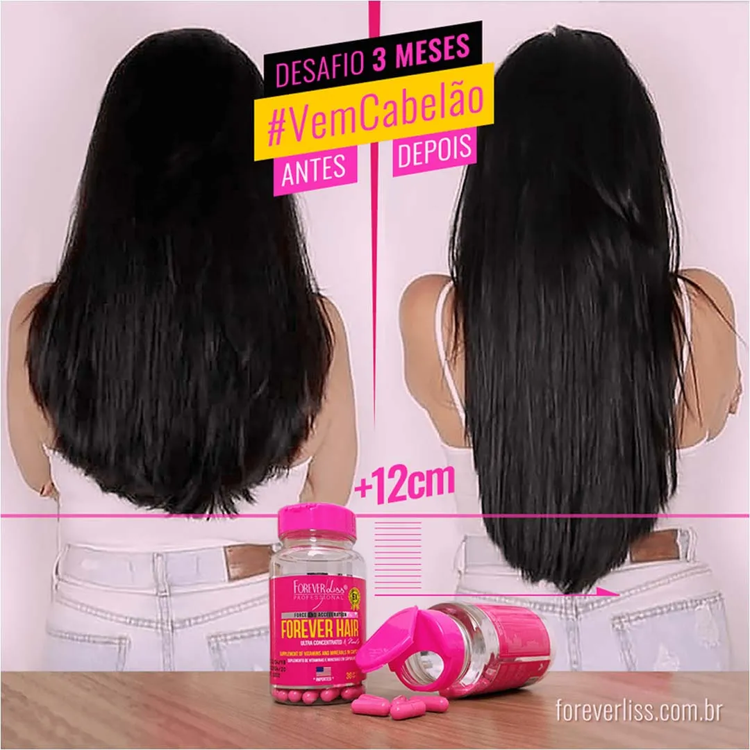 Forever Liss Forever Hair Crescimento Capilar Tratamento 30 dias ...