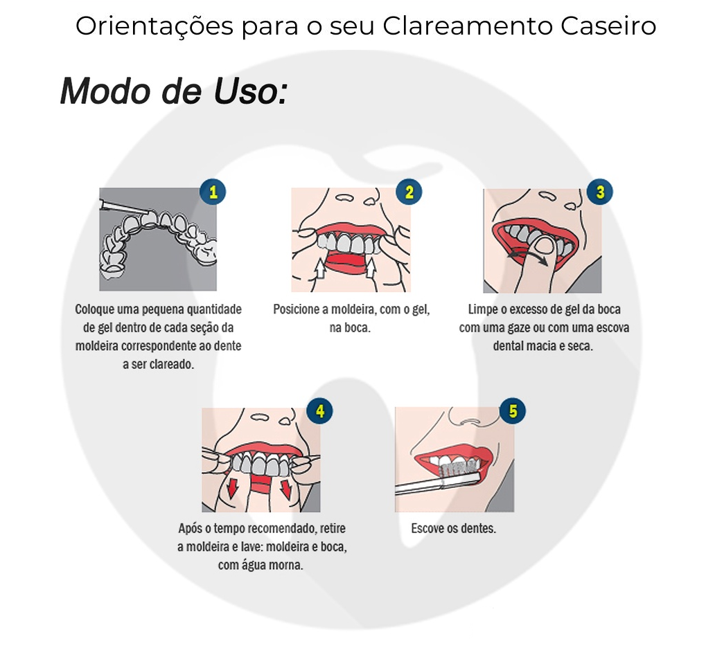 Clareador Dental Whiteness Simple 16% - 3 Un + Moldeira - Dental RM ...