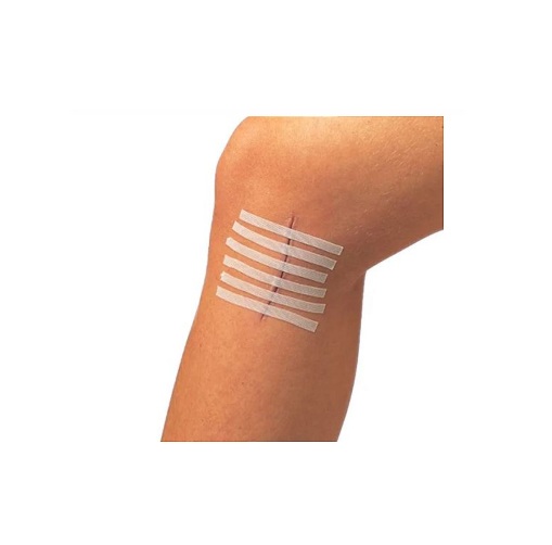 Curativo Ponto Falso Leukostrip 13cm x 102mm C/6 TIras - Smith & Nephew ...