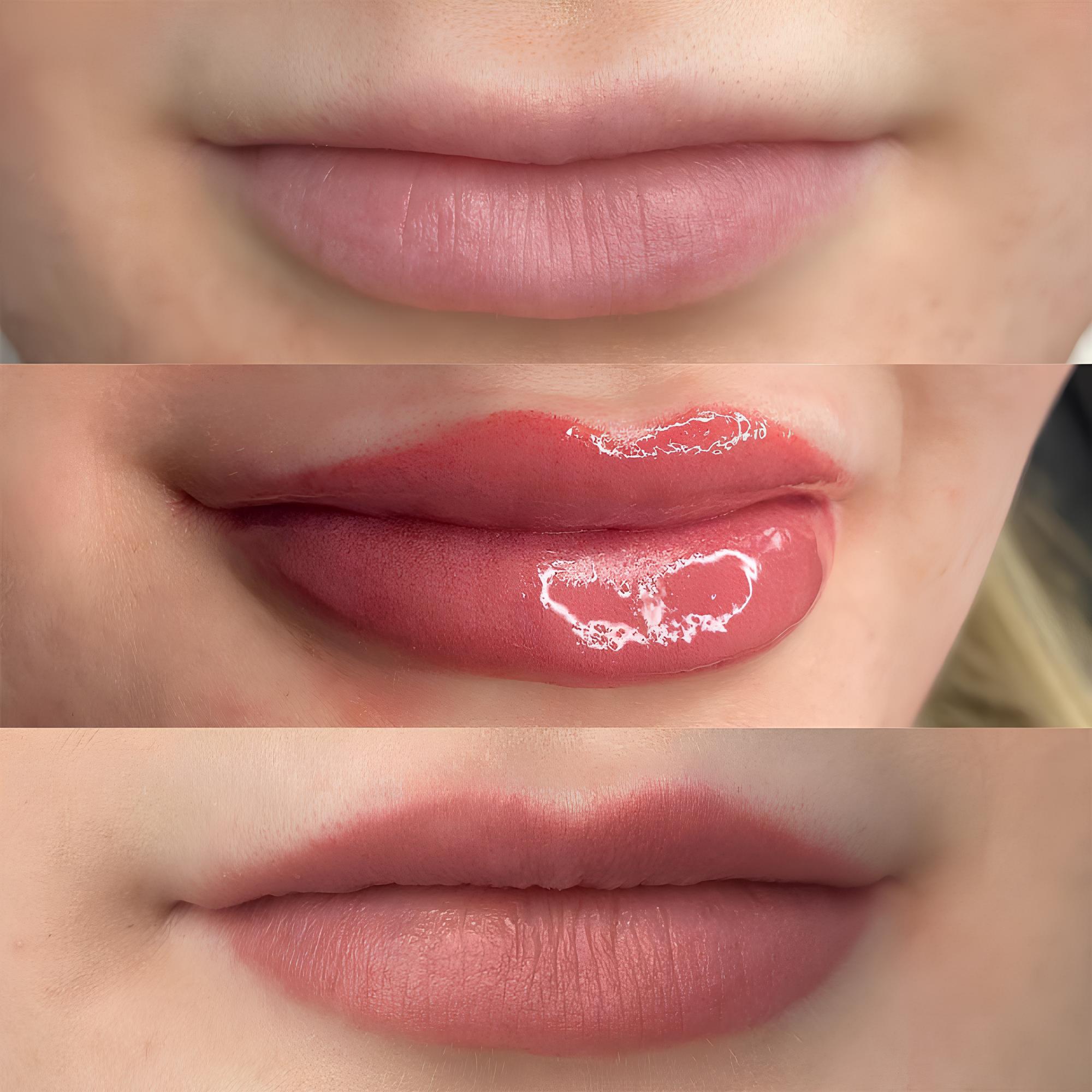 Zero Dor Labial - Anestésico Eficaz para Procedimentos em Lábios - Nano ...