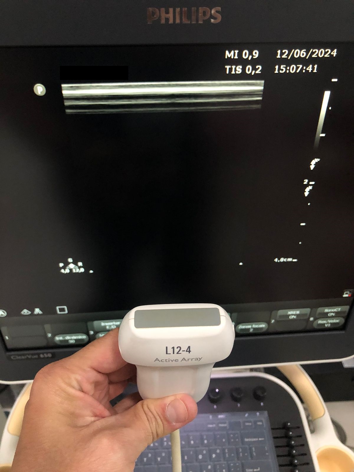 Trandutor clear vue philips - PORTAL DO ULTRASSOM