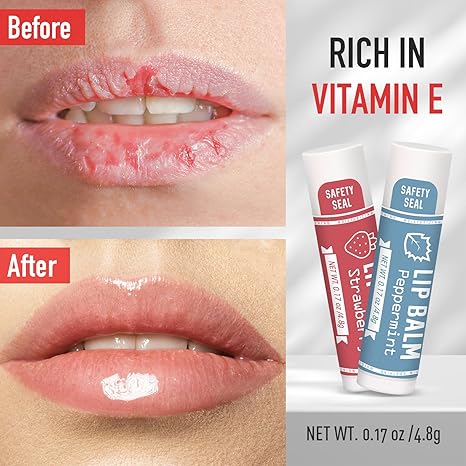 LIP BALM PROTETOR LABIAL AZEN-LIP IMPORTADO NA BABY STYLE. - BabyStyle ...