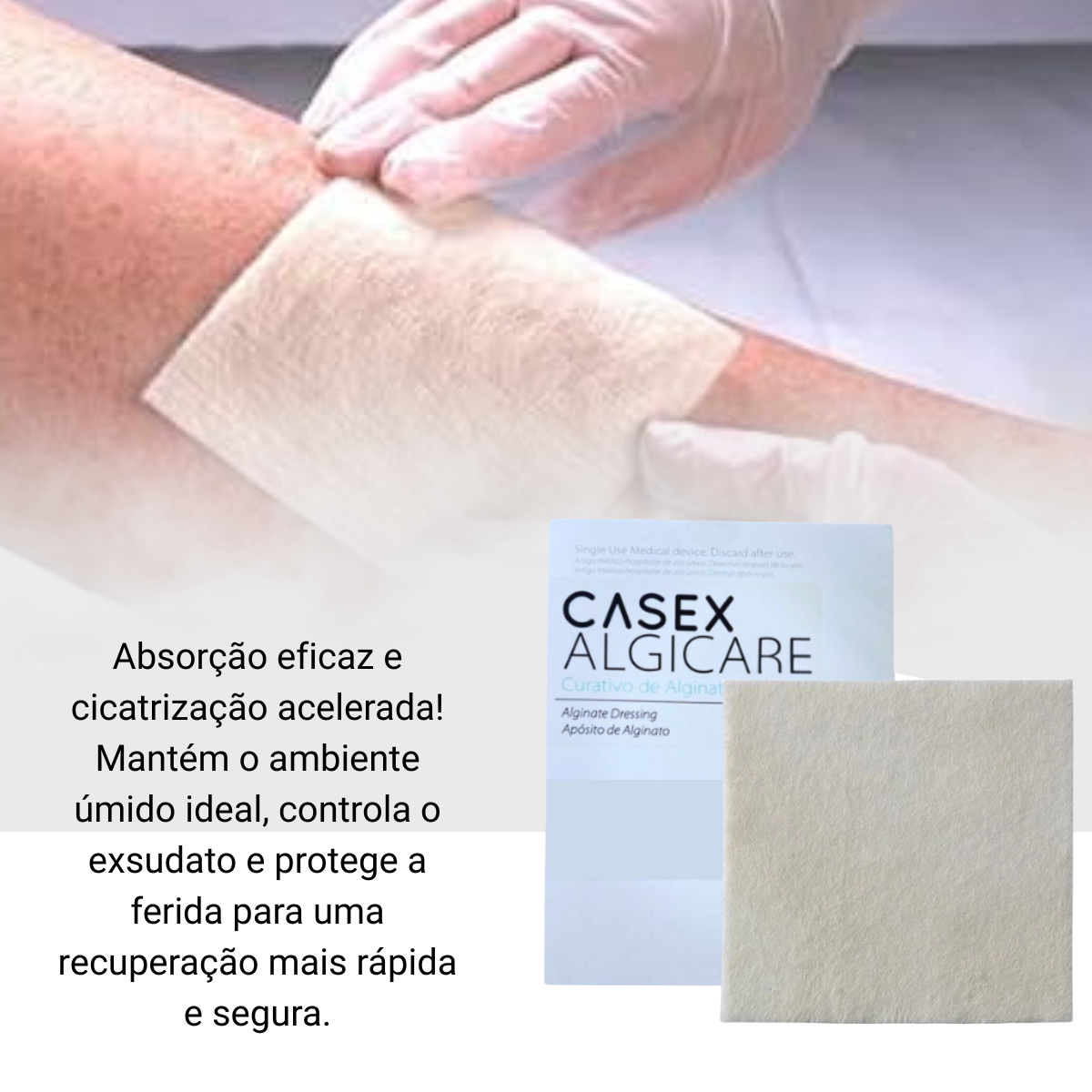 Algicare Curativo de Alginato de Calcio 10cm x 10cm - Casex - RareMed ...