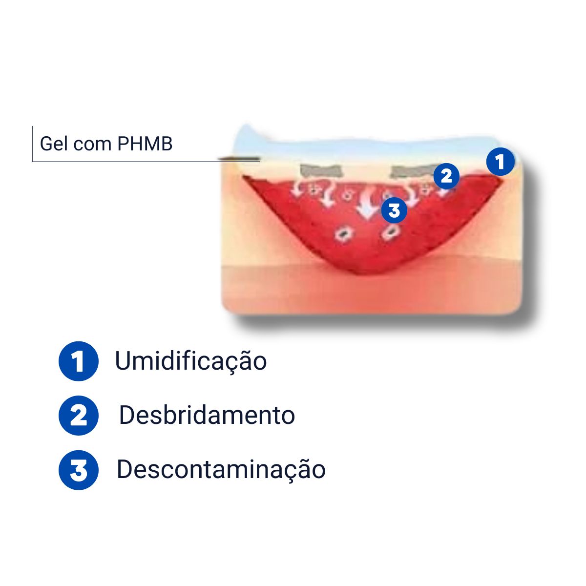 Gel de Limpeza com PHMB + EDTA - Curatec - RareMed - Hospitalar