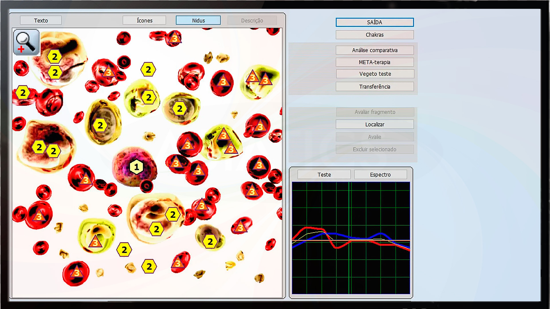 Analisador Biorressonância Quântico NLS 18D Diagnóstico e Tratamento - Asiatics Online