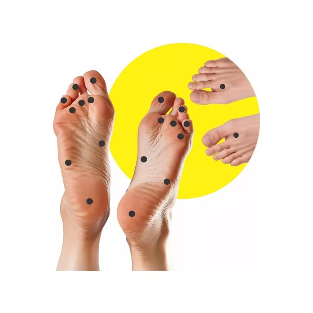 Estesiometro Monofilamento De Semmes-weinstein Ortho Pauher ...