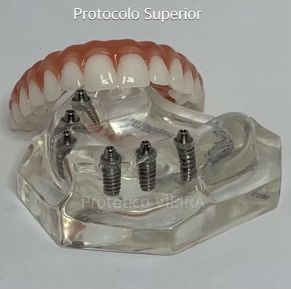 Modelos Odontológicos Protocolo Supe e Over Barra Clip Inf - Manequins ...