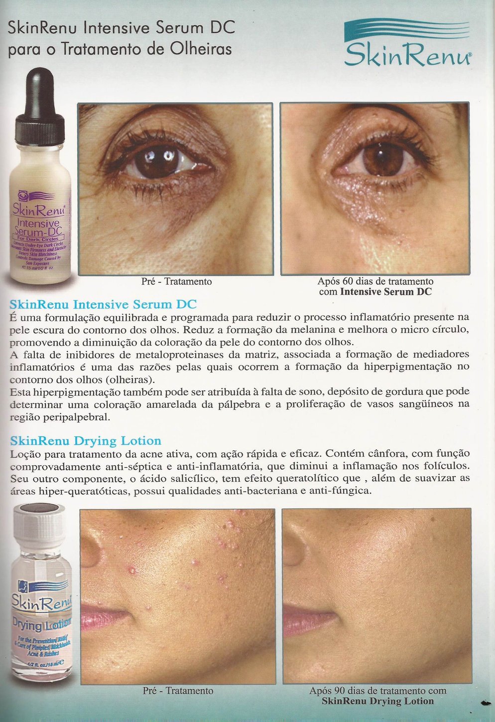 DRYING LOTION - SKIN RENU - Celia Bannitz Distribuidora - São Paulo