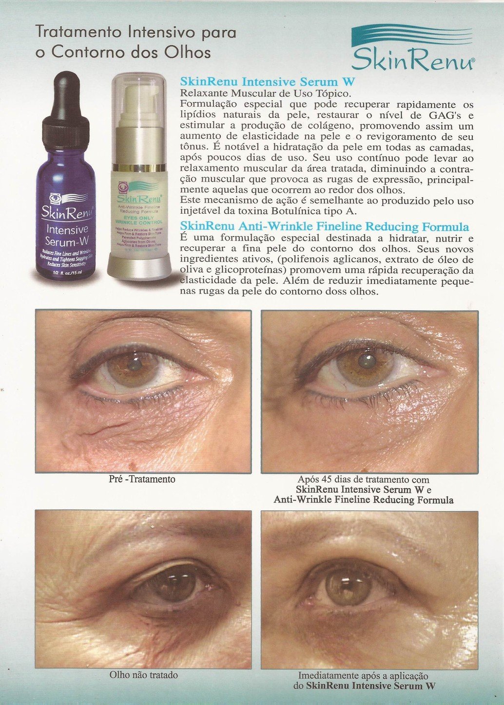 ANTI-WRIKLE FINELINE REDUCTING FORMULA - SKIN RENU - Celia Bannitz ...