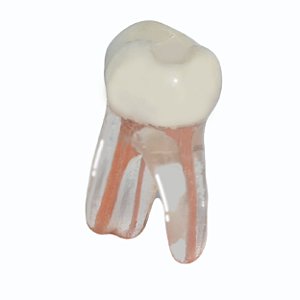 Dentes Decíduos - Tecnodon Manequins Odontológicos