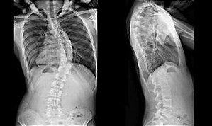 Rx Dinâmico da Coluna Cervical - Orto Center