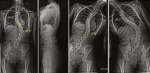 Rx Dinâmico da Coluna Cervical - Orto Center