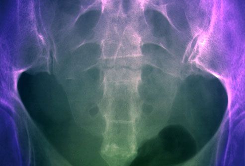 CIÁTICA - imaterapia