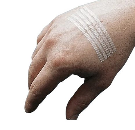 Curativo Skin-Strip Ponto Falso C/12 Tiras - Skinupper - Cirúrgica ...