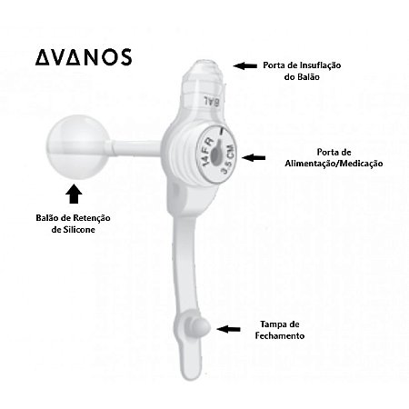 SONDA DE GASTROSTOMIA DE BAIXO PERFIL COM BALÃO - MICKEY - AVANOS ...