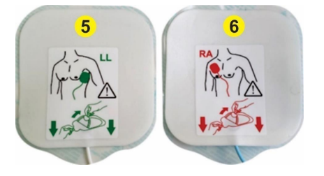 Desfibrilador Externo Automático DEA Life 400 Futura – CMOS DRAKE - OrthoHouse - Cama Hospitalar ...