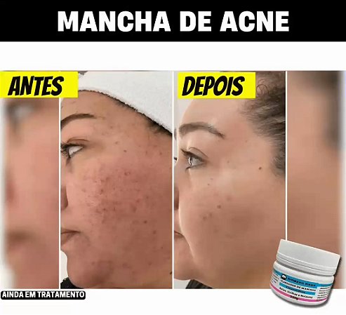 CLAREADOR DE MANCHAS AMAZOLE - Amazon kaps