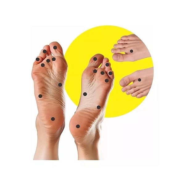 Estesiometro Monofilamento De Semmes-weinstein Ortho Pauher - Produtos ...