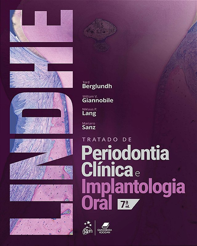 TRATADO DE PERIODONTIA CLINICA E IMPLANTOLOGIA ORAL - 7ª Edição 2024 ...