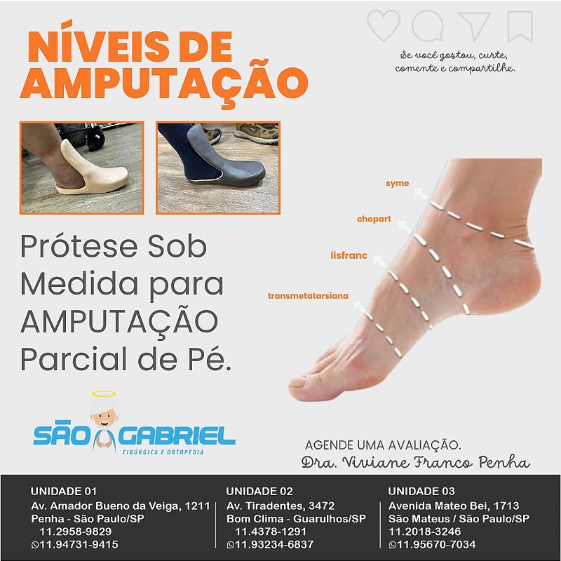 Prótese para Amputação Parcial de Pé sob medida - Cirúrgica São Gabriel ...