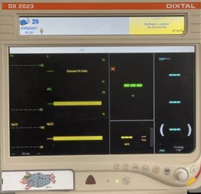Monitor Multiparamétrico DX2023 marca Dixtal - BPM Hospitalar produtos ...