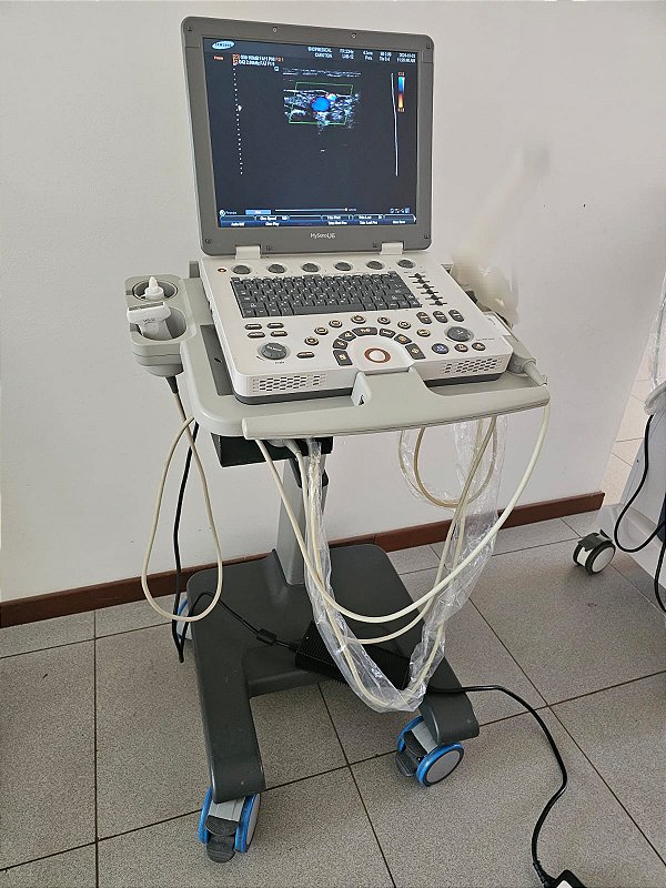 Ultrassom Portátil MySono U6 - Linear e Setorial - SAMSUNG - Shopmedical