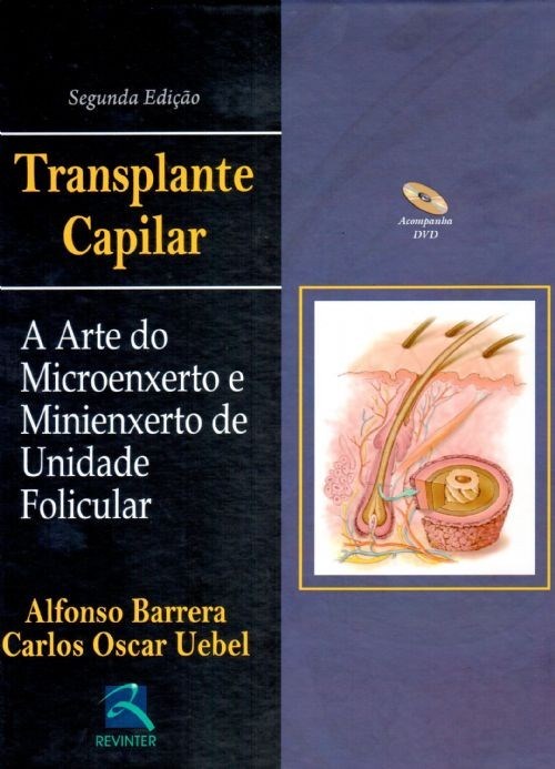 Livro Transplante Capilar - Livraria Florence | Livros de Medicina ...