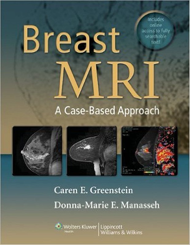 Breast Mri - Livraria Internacional SBS