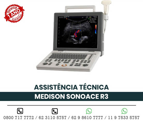 ULTRASSOM PORTATIL MEDISON SONOACE R3 - TUDO ULTRASSOM BRASIL